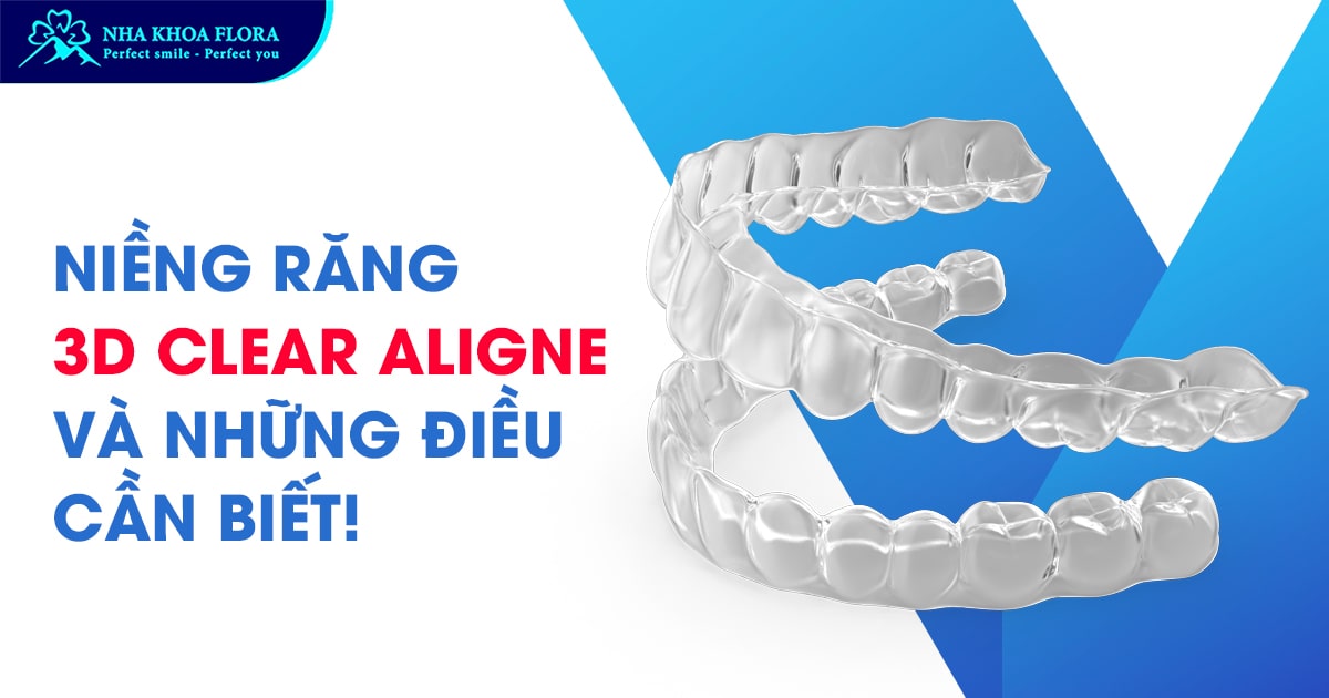 Niềng Răng Không Mắc Cài 3D Clear Và Những điều Cần Biết!