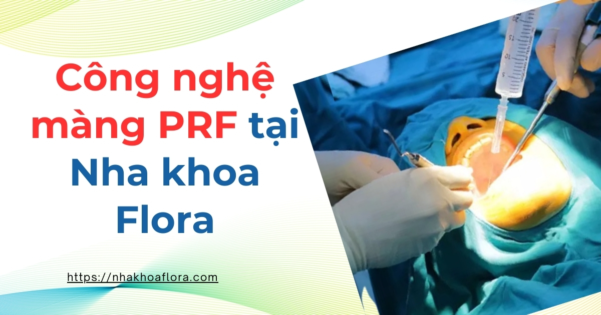 Nha Khoa Flora áp Dụng Công Nghệ Màng PRF Vào Cấy Ghép Implant