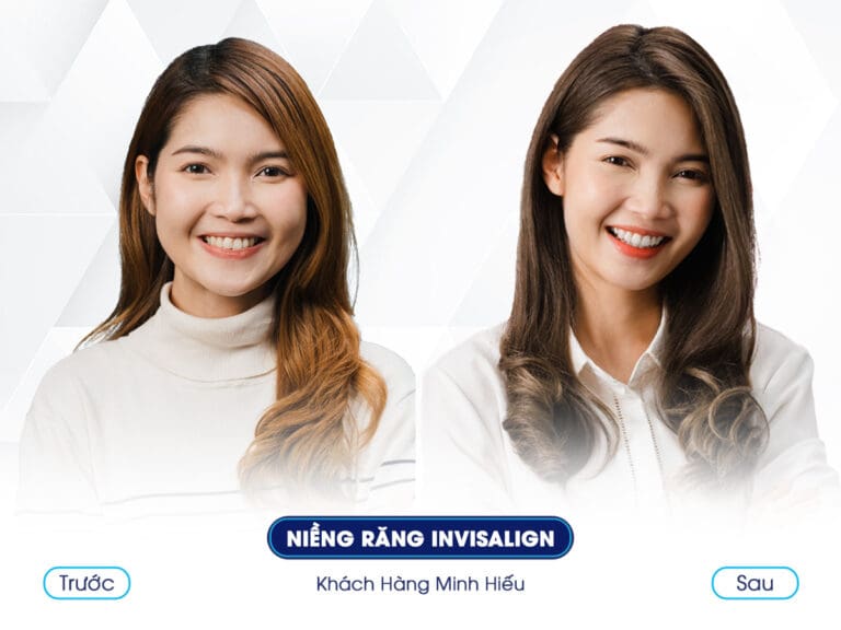 Nha Khoa Flora | Hệ Thống Nha Khoa Êm Ái Tiêu Chuẩn Thụy Sĩ