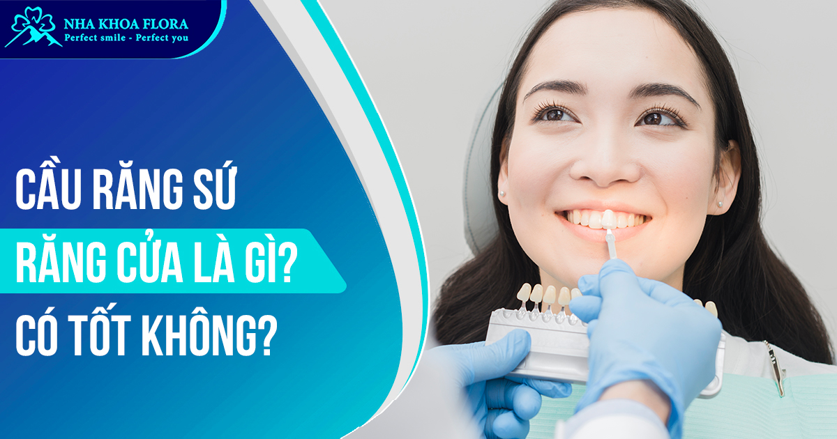 Cầu Răng Sứ Răng Cửa Là Gì? Có Tốt Không? Giá Bao Nhiêu?