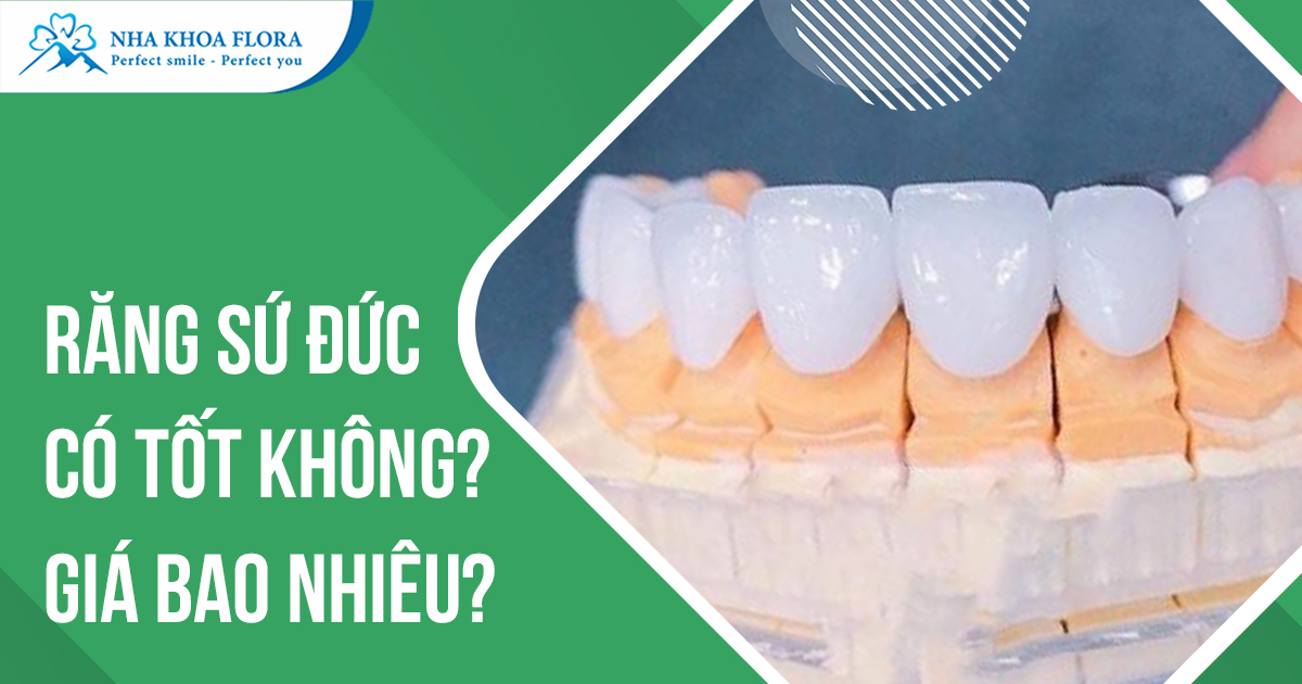 Răng Sứ Đức Có Mấy Loại? Có Tốt Không? Giá Bao Nhiêu?