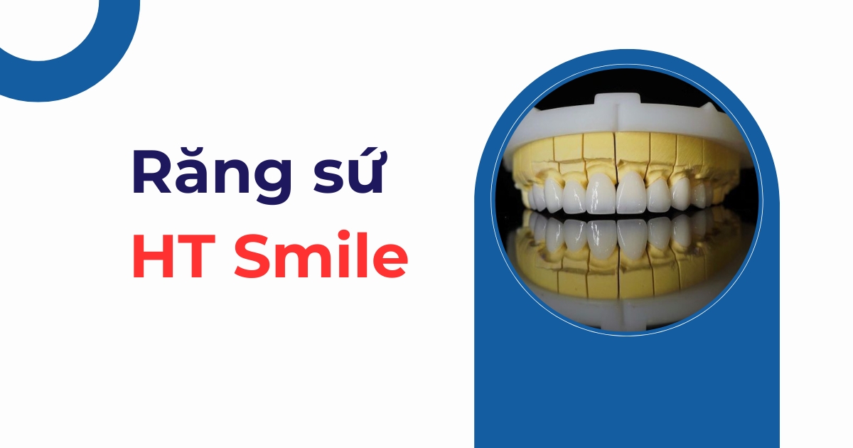 Răng Sứ HT Smile Của Nước Nào? Có Tốt Không? Giá Bao Nhiêu?