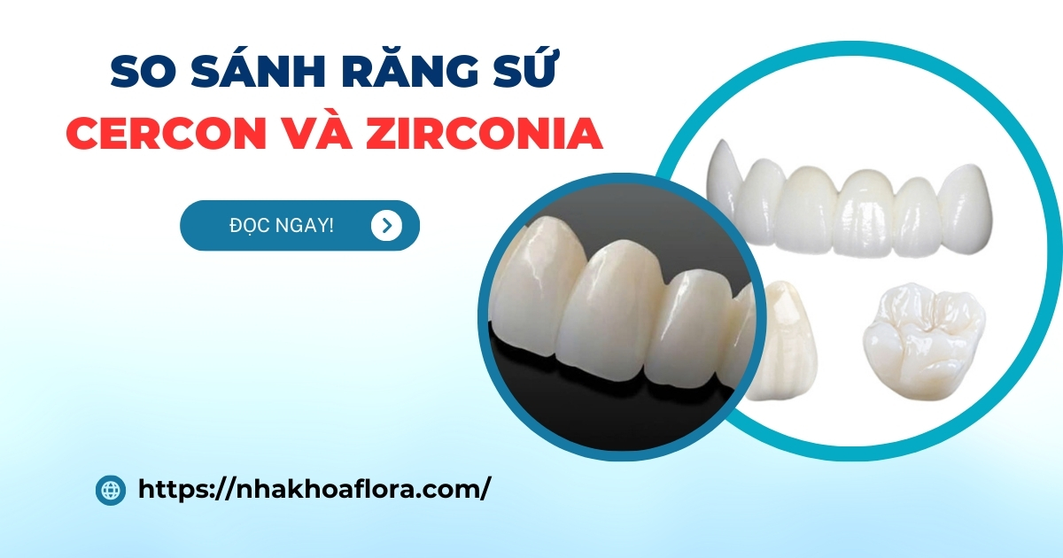So Sánh Răng Sứ Cercon Và Zirconia? Chọn Loại Nào Tốt Hơn?