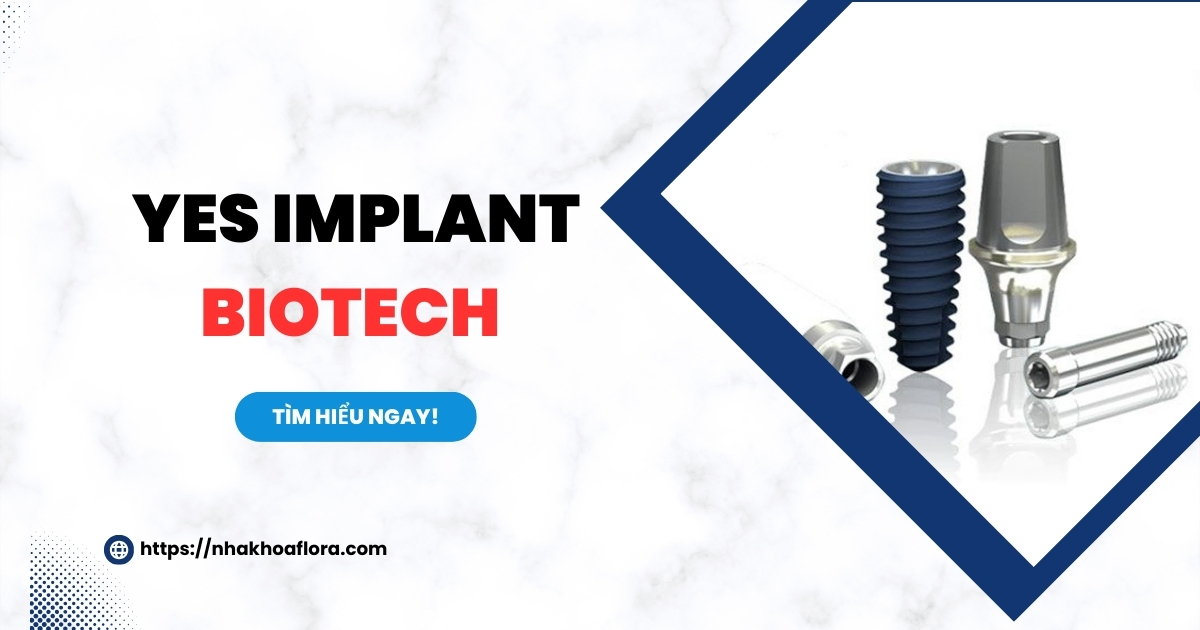 Review Trụ Yes Implant: Xuất Xứ, Có Tốt Không, Giá Cả?