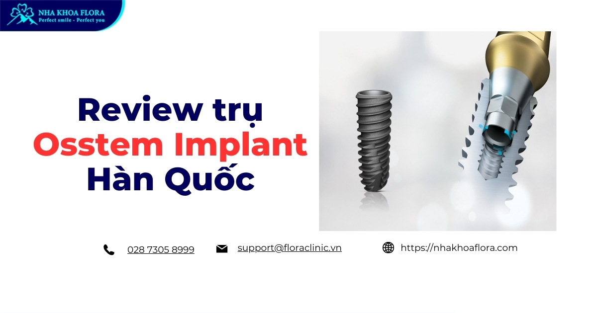 Trụ Osstem Implant: Xuất Xứ, Có Tốt Không, Giá Bao Nhiêu?