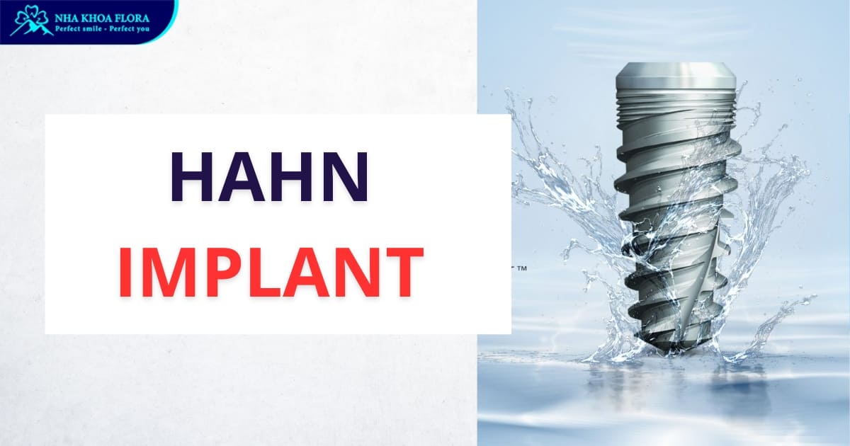 Trụ Hahn Implant: Xuất Xứ, Có Tốt Không, Giá Bao Nhiêu?