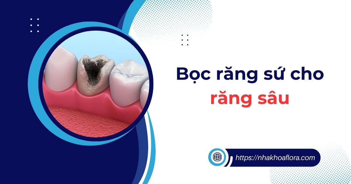 Bọc Răng Sứ Cho Răng Sâu Có đau Không? Giá Bao Nhiêu Tiền?