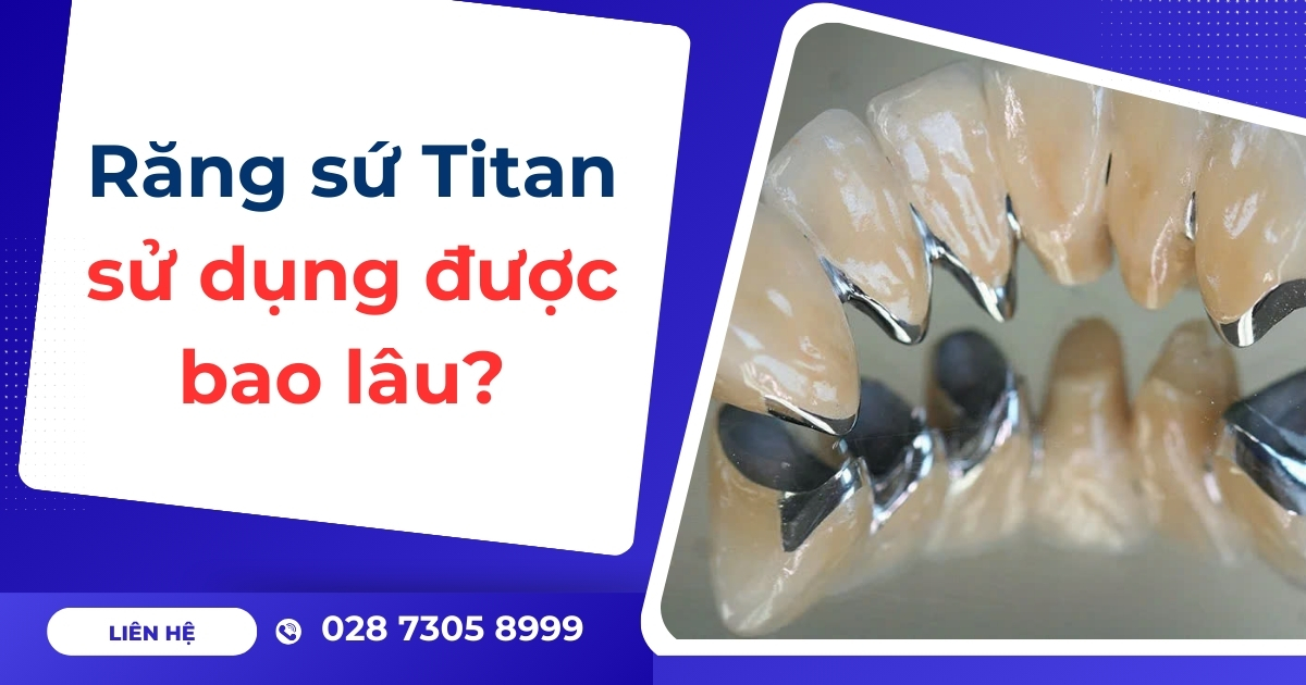Răng Sứ Titan Sử Dụng được Bao Lâu Thì Phải Thay Mới Lại?