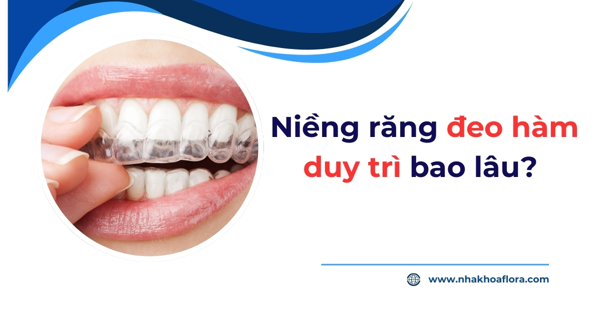 Niềng Răng đeo Hàm Duy Trì Bao Lâu? Có Phải đeo Cả đời?